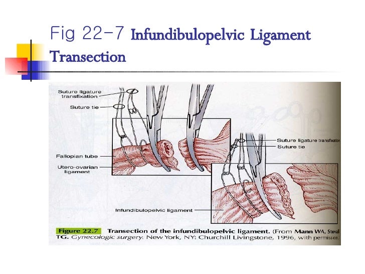 Abdominal ve Vajinal Histerektomi - www.jinekolojivegebelik.com