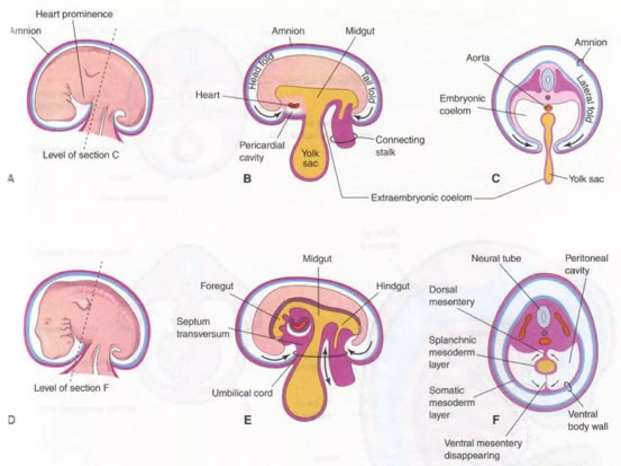 Abdominal wall-defects | PPT