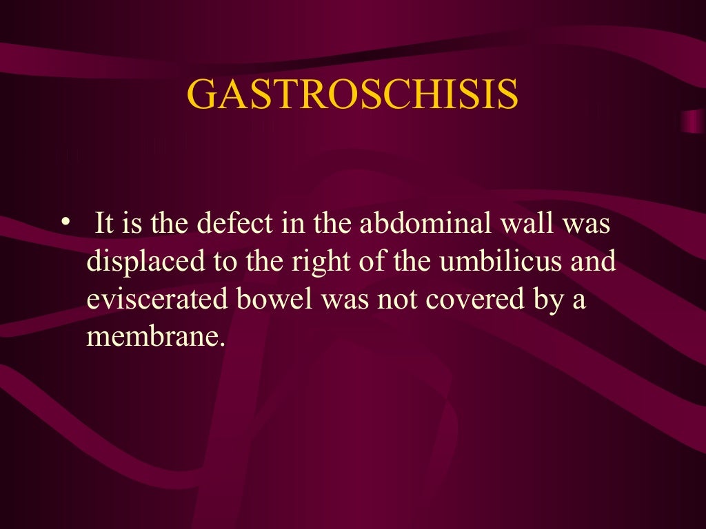 Abdominal wall-defects