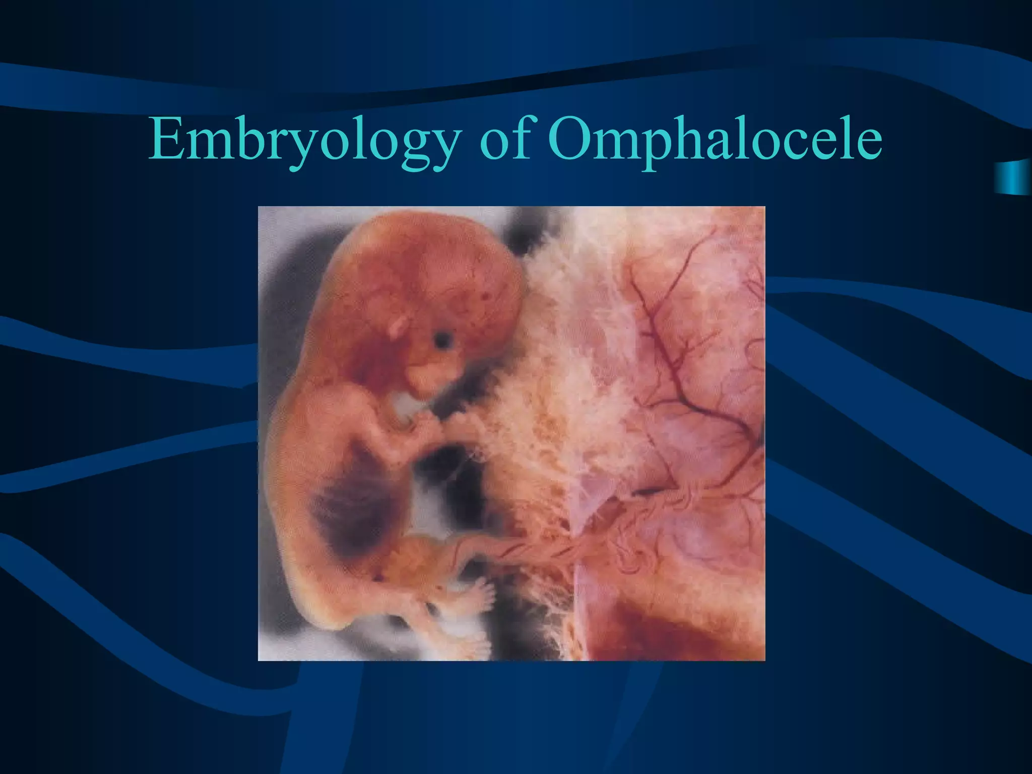 Abdominal wall-defects | PPT