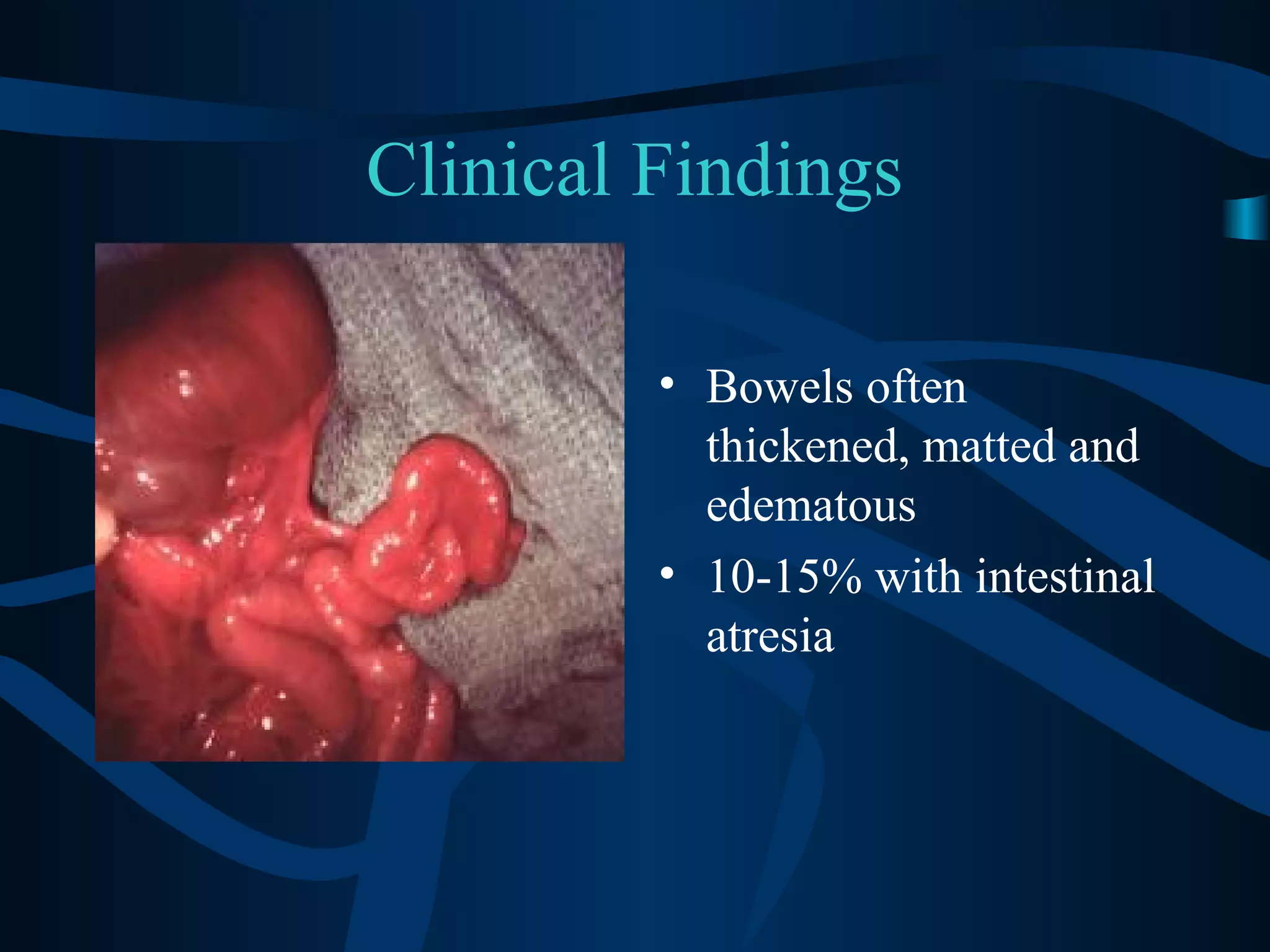 Abdominal wall-defects | PPT