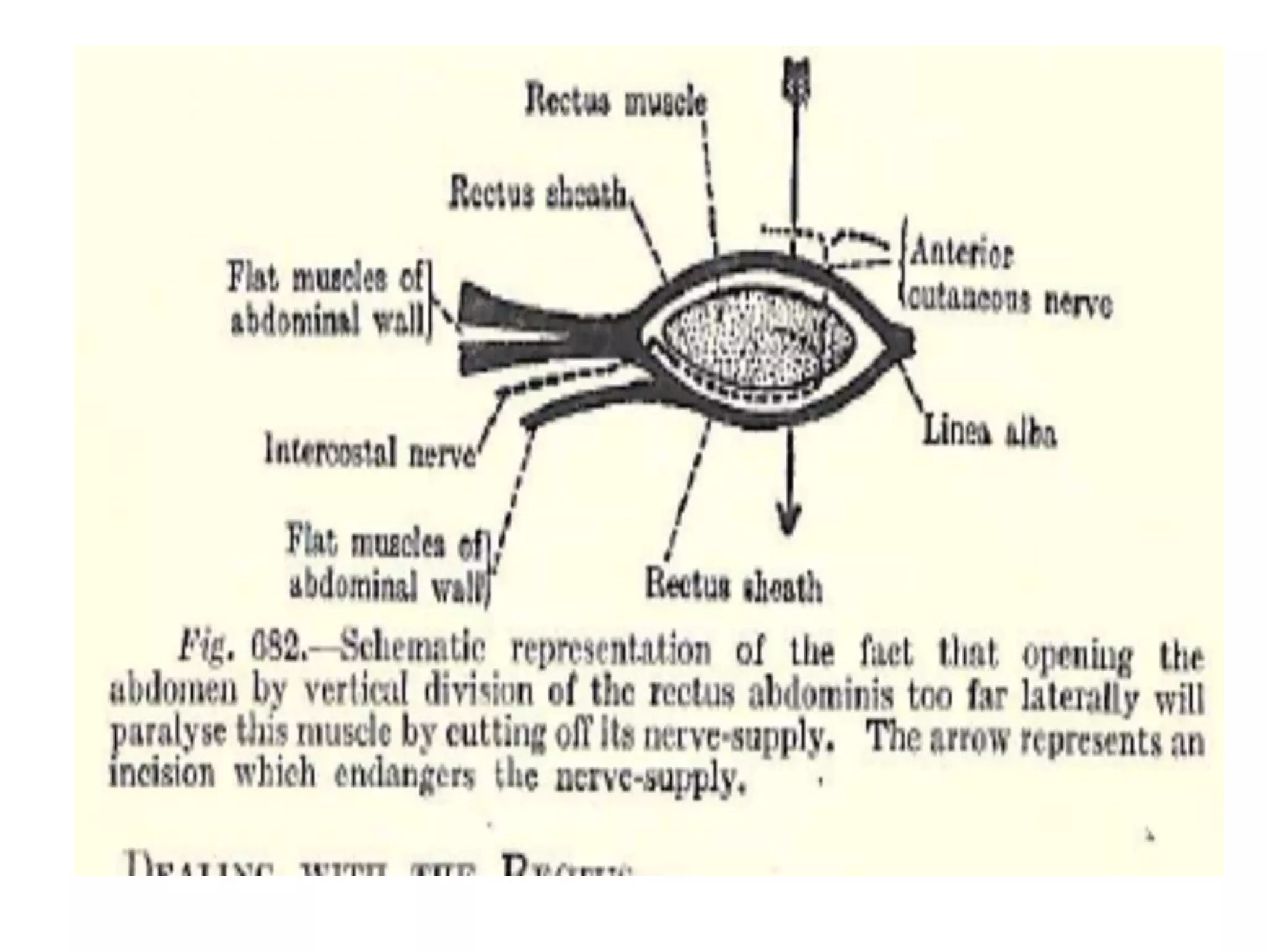 Abdominal access presentation | PPTX