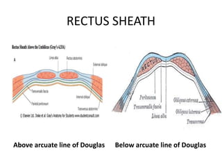Rectus Sheath Arcuate Line