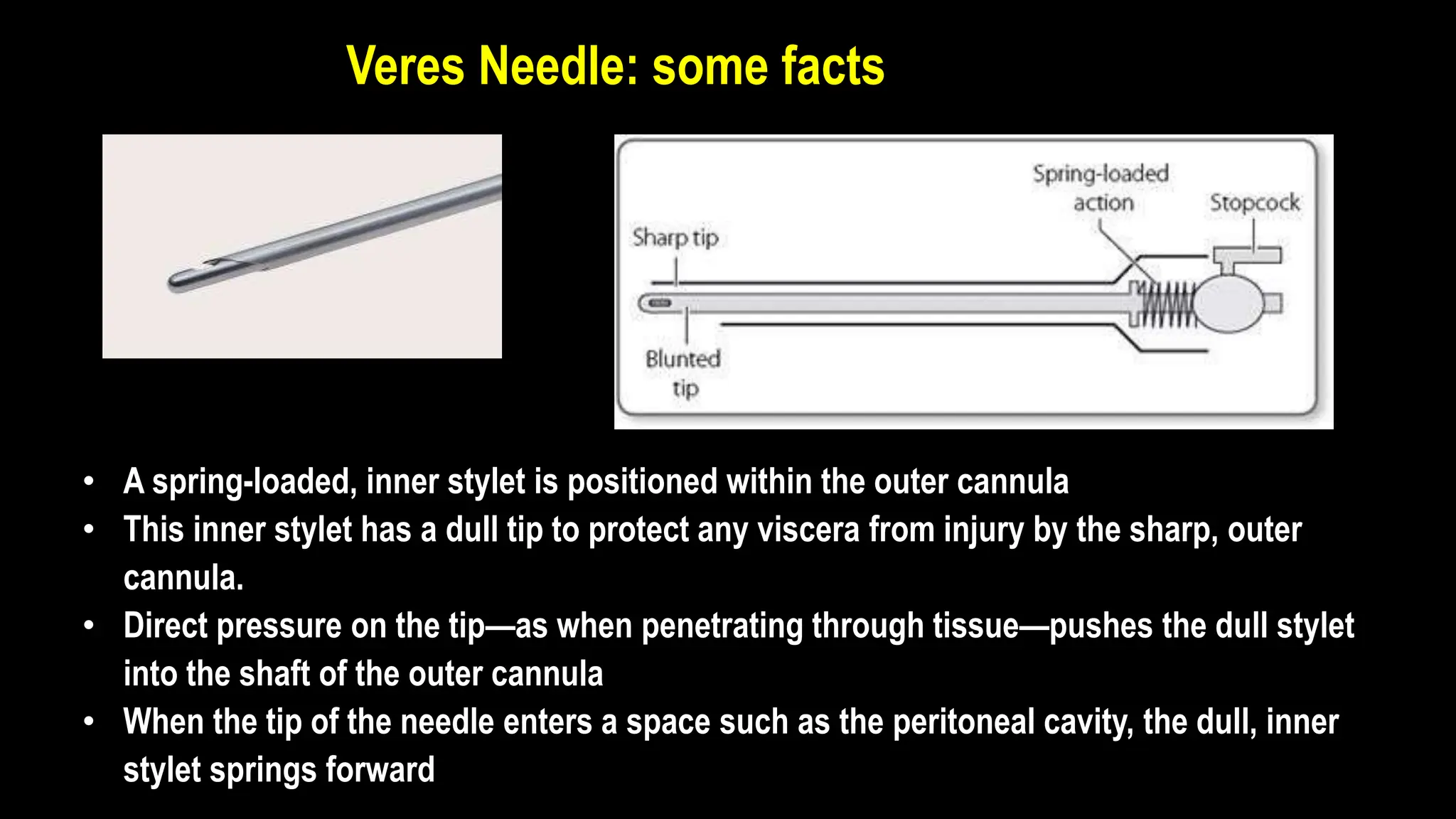 Abdominal Access Techniques in laparoscopy | PPT