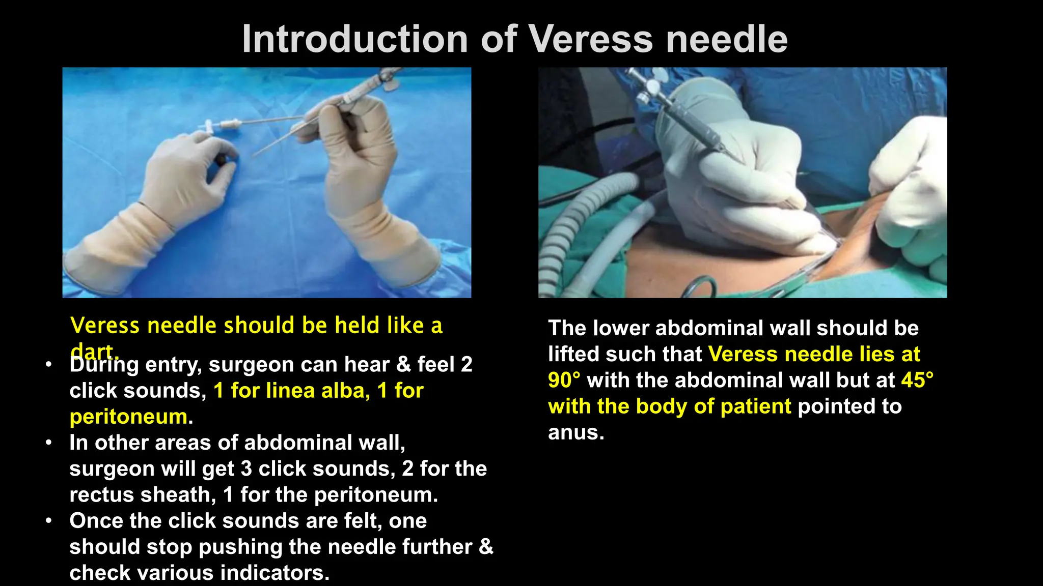 Abdominal Access Techniques in laparoscopy | PPT