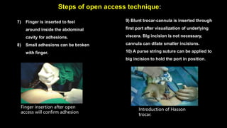 Abdominal Access Techniques in laparoscopy | PPTX