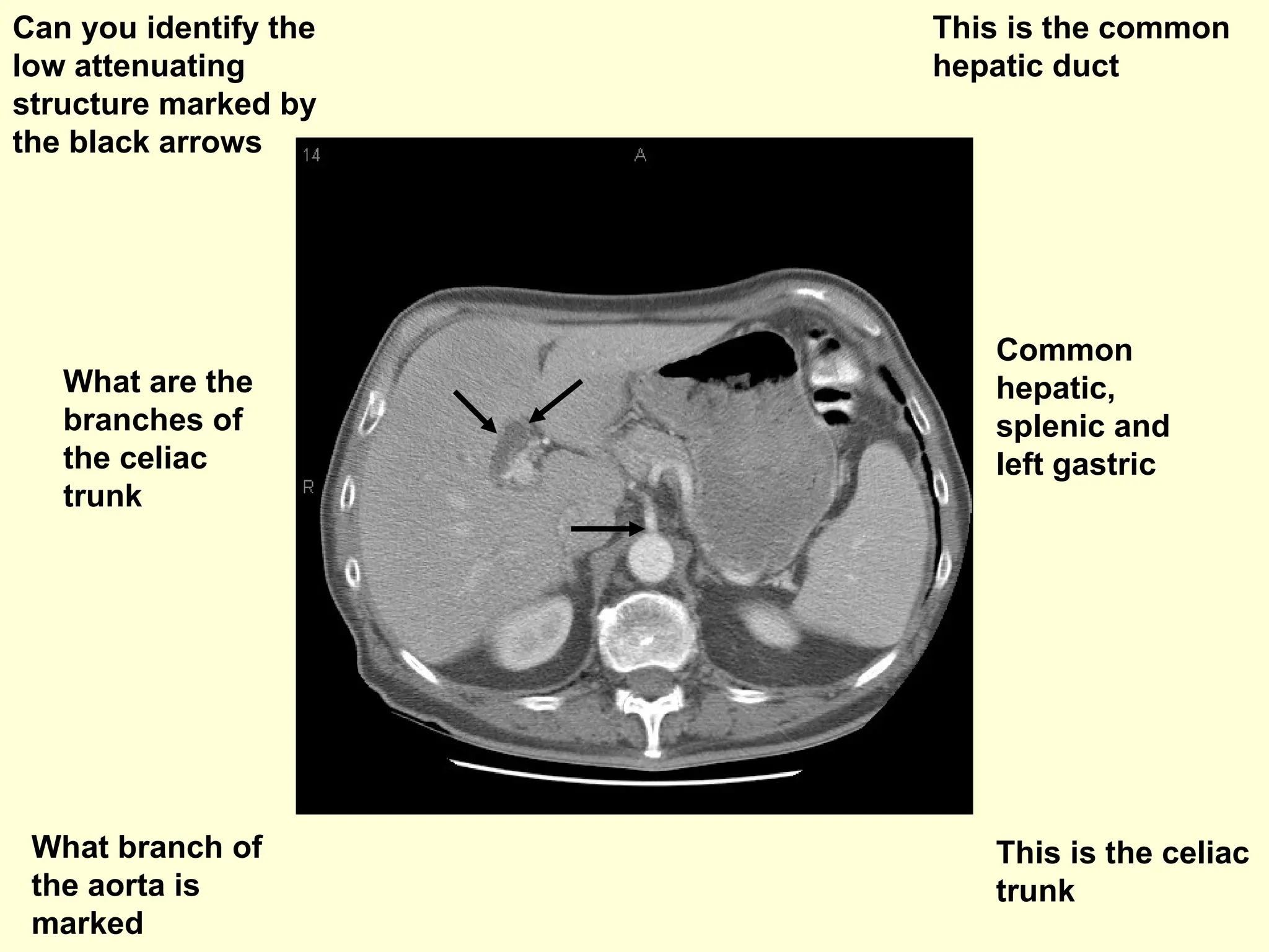 abdominal_anatomy_166091_284_6602_v1.ppt