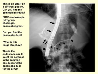abdominal_anatomy_166091_284_6602_v1.ppt
