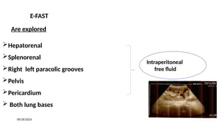 Abdominal and Pelvic Trauma for Medical students/residents pptx | PPTX