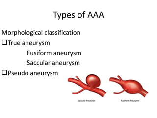 ABDOMINAL AORTIC ANEURSUM.pptx | Digestive Disorders | Diseases and ...