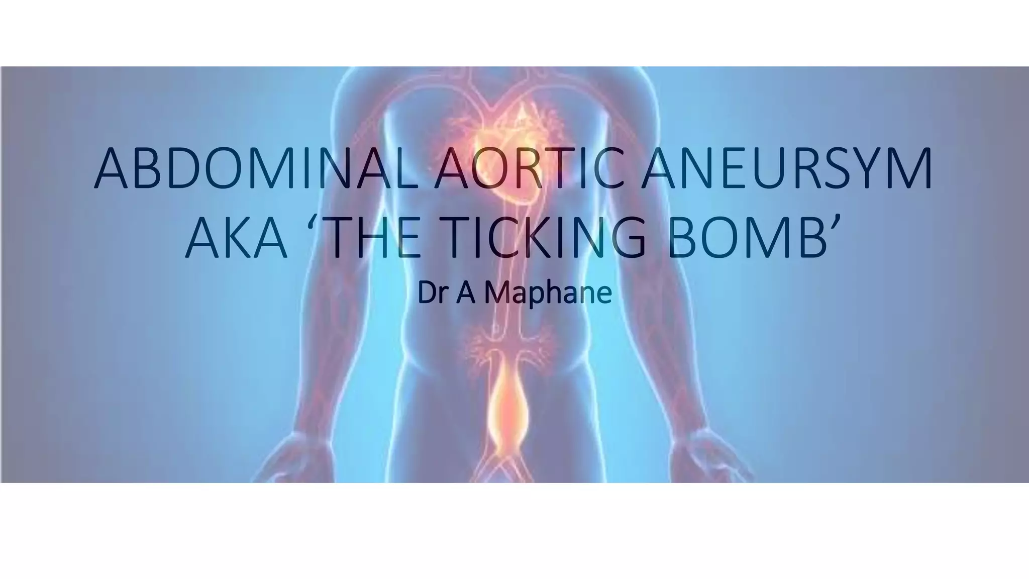 Abdominal aortic aneurysm | PPTX