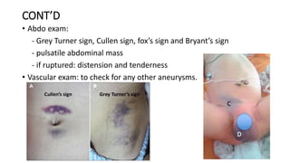 Abdominal aortic aneurysm | PPTX