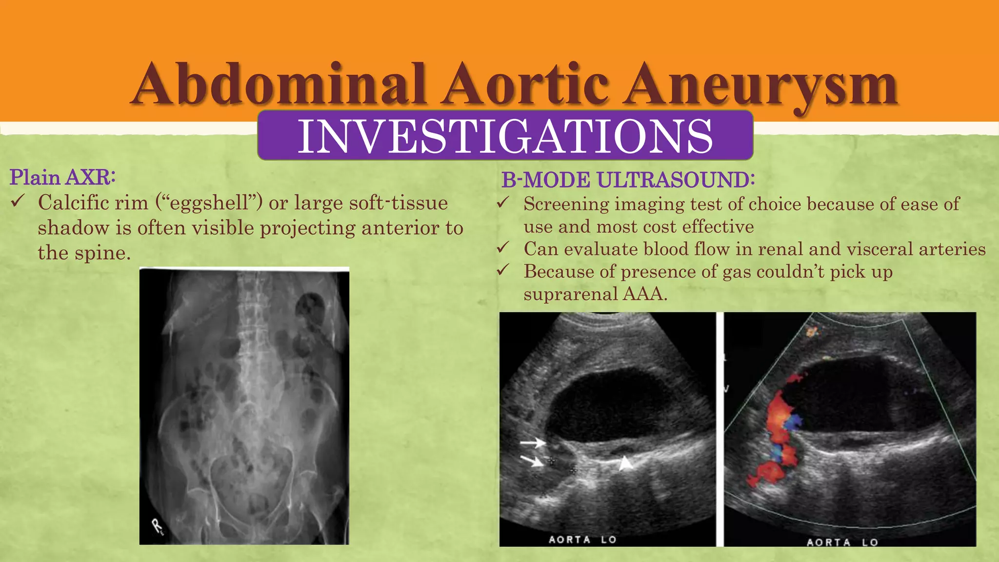 ABDOMINAL AORTIC ANEURYSM- EPIGASTRIC LUMPS- Abdominal Lumps.pptx