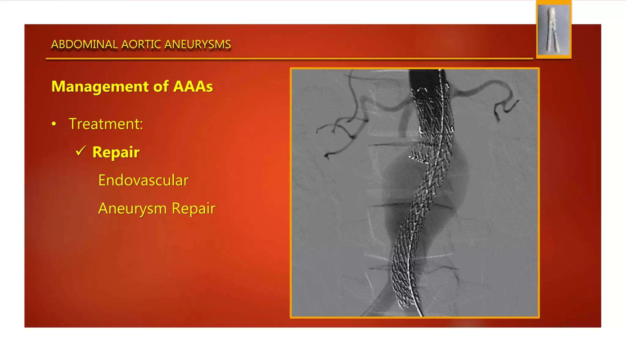 Endovascular Aortic Aneurysm Repair | PPTX