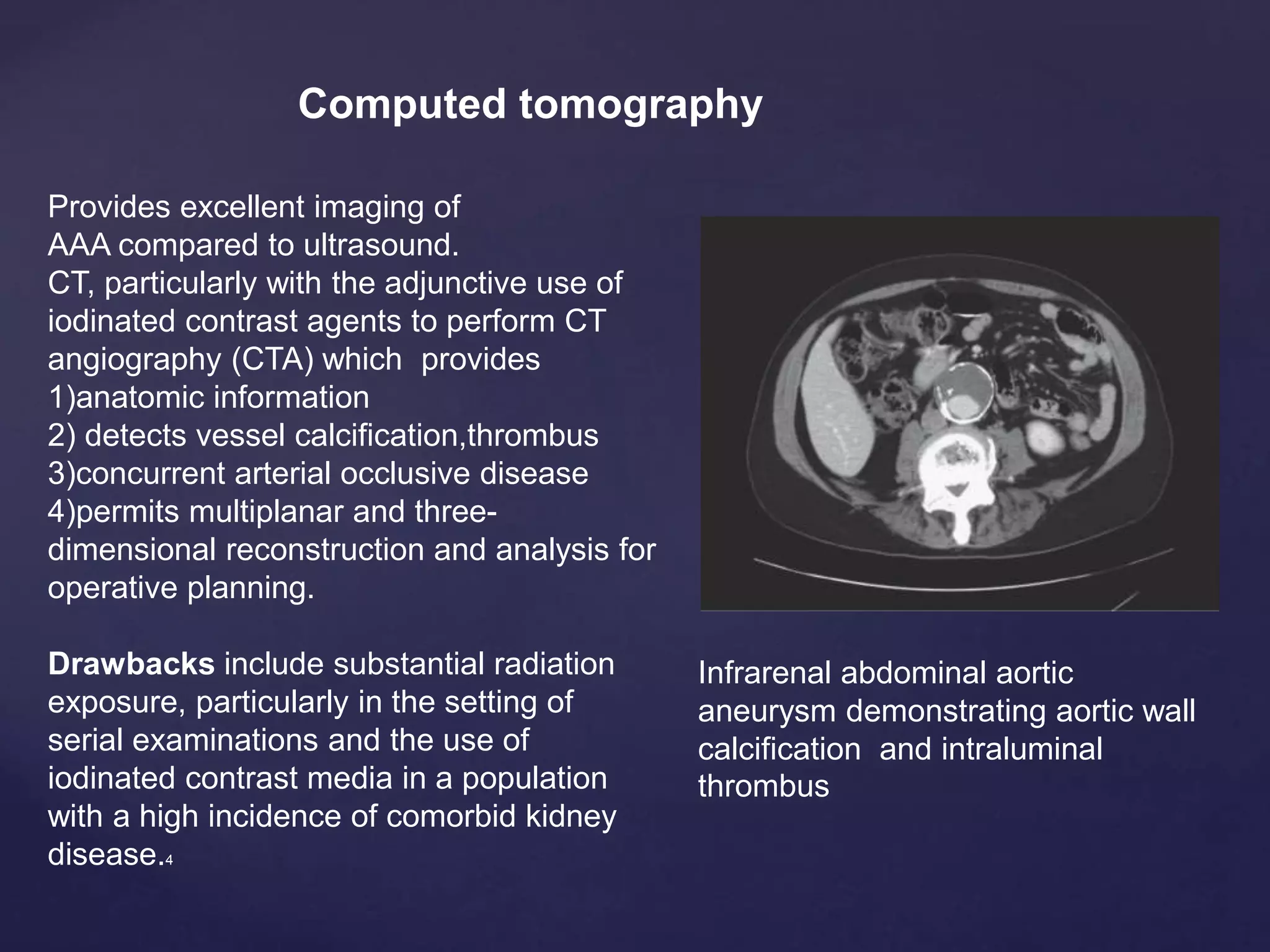 Abdominal aortic aneurysm | PPTX