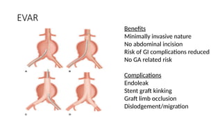Abdominal Aortic aneurysm intro till management .pptx
