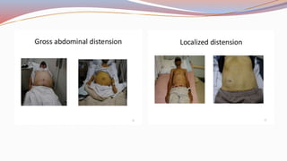 Abdominal Assessment.pptx