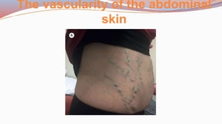 Abdominal Assessment.pptx