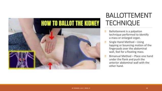 ABDOMINAL ASSESSMENT - HEALTH ASSESSMENT | PPTX | Digestive Disorders ...