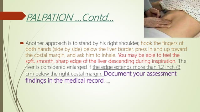 ABDOMINAL ASSESSMENT ASSESSMENT, AUSCULTAION, PERCUSSION & PALPATION ...