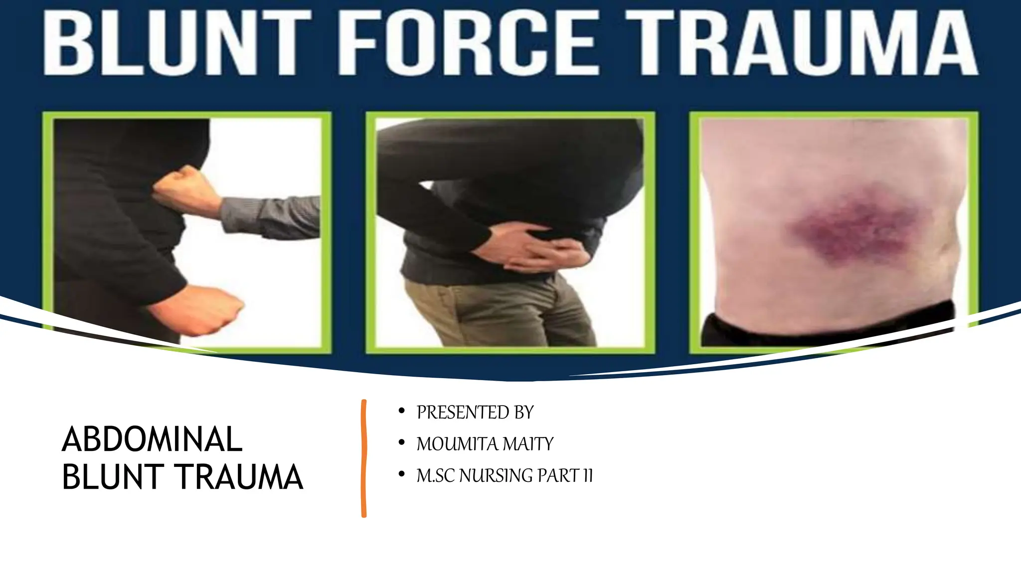 ABDOMINAL BLUNT TRAUMA.pptx