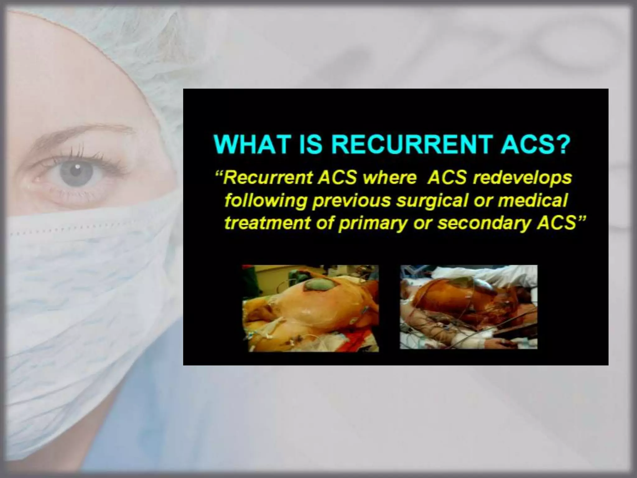 Abdominal compartment syndrome | PPTX