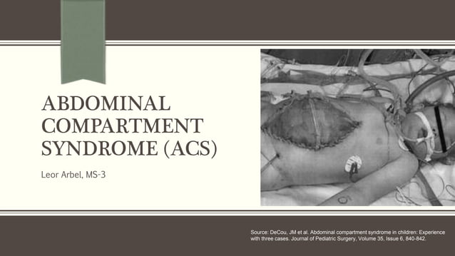 Abdominal compartment syndrome | PPT