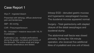 Abdominal Compartment Syndrome.pdf