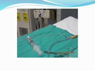Abdominal compartment syndrome (ACS) .pptx