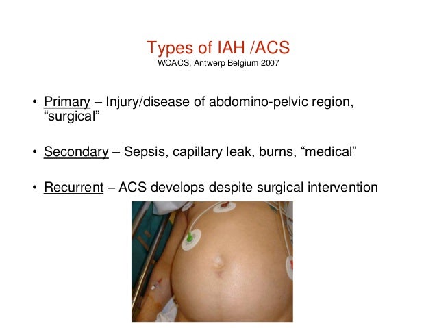 Abdominal compartment syndrome and septic abdomen