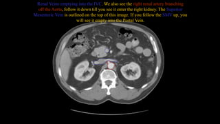 Ct Of Abdomen Without Contrast