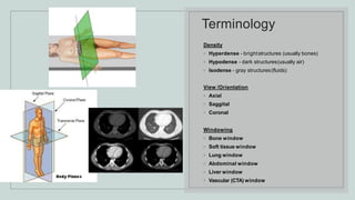 ABDOMINAL CT SCAN.pptx