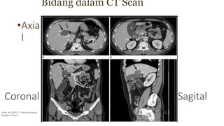 ABDOMINAL CT SCAN.pptx