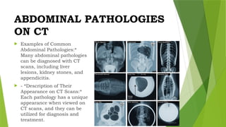 ABDOMINAL COMPUTED TOMOGRAPHY SCAN ANATOMY.pptx