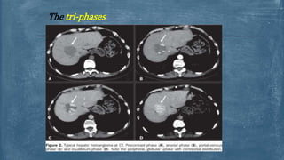 CT scan Liver examination | PPTX