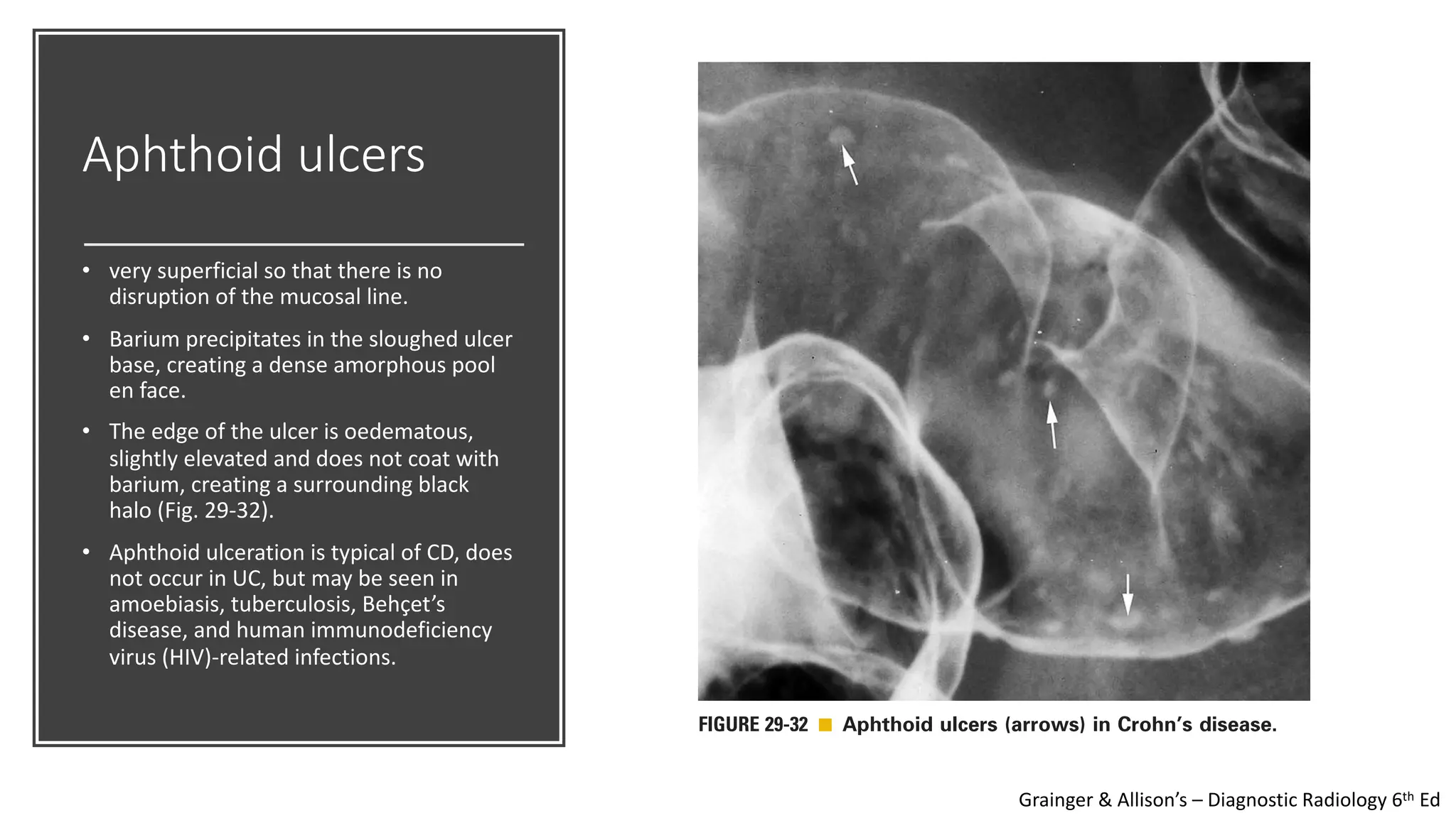 Abdominal disease | PDF