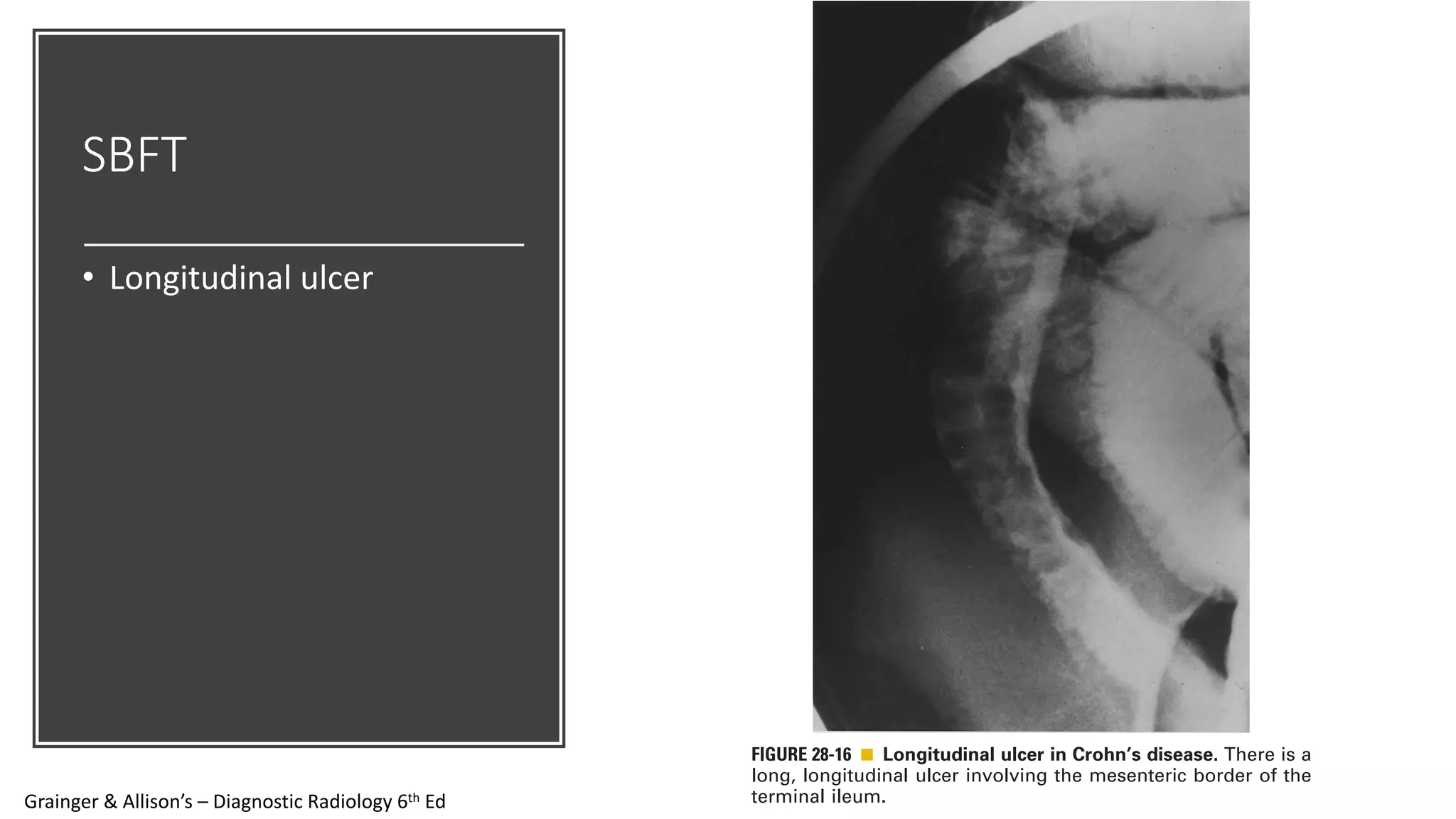 Abdominal disease | PDF