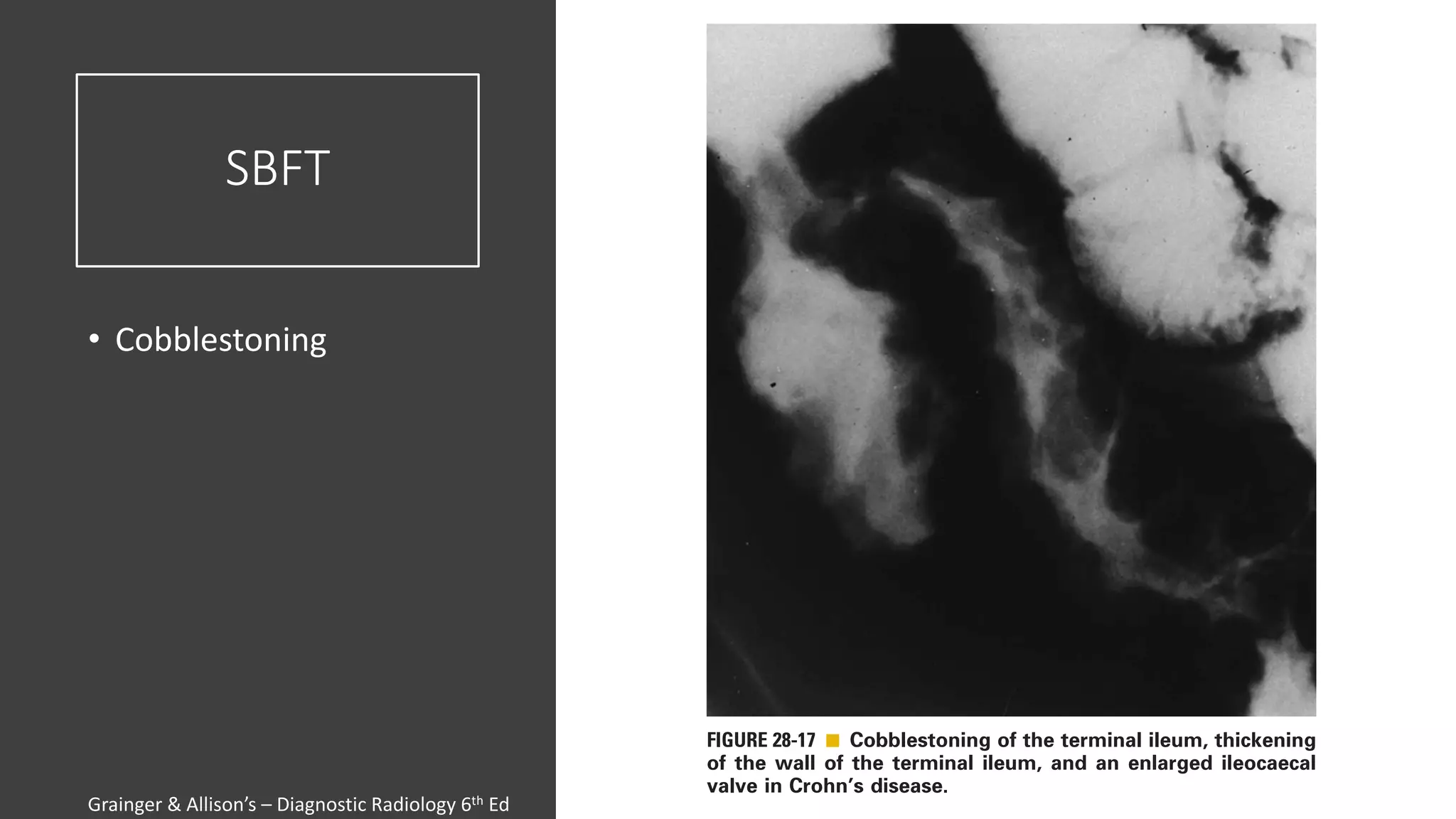 Abdominal disease | PDF
