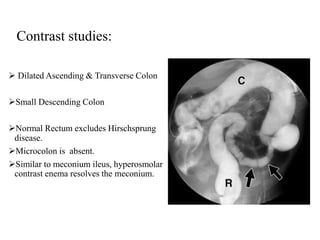 Abdominal Distension in Neonates Part 2.pptx