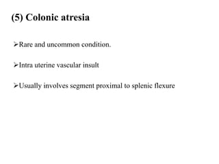 Abdominal Distension in Neonates Part 2.pptx