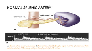 ABDOMINAL DOPPLER AND VASCULAR IMAGING. and pathologies | PPTX