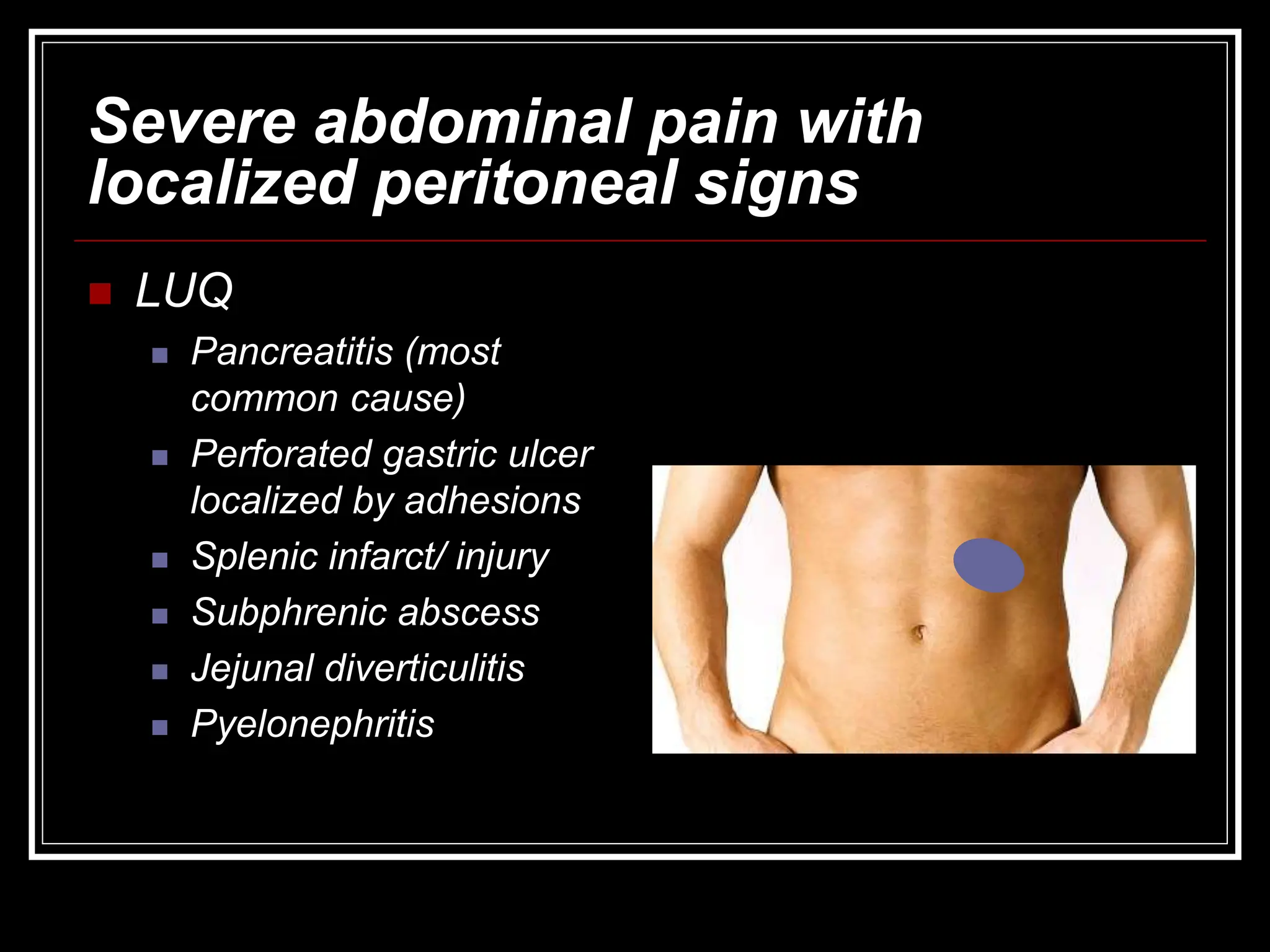 Abdominal Exam.ppt palpation auscaltation alll ae done | PPT