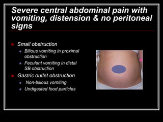 Abdominal Exam.ppt palpation auscaltation alll ae done | PPT