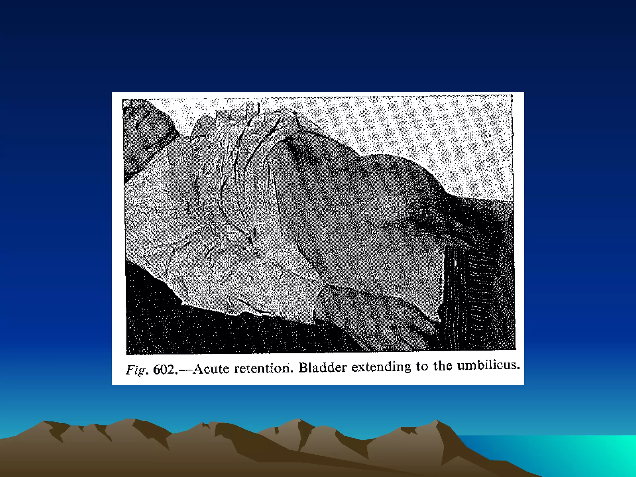 Abdominal examination | PPT
