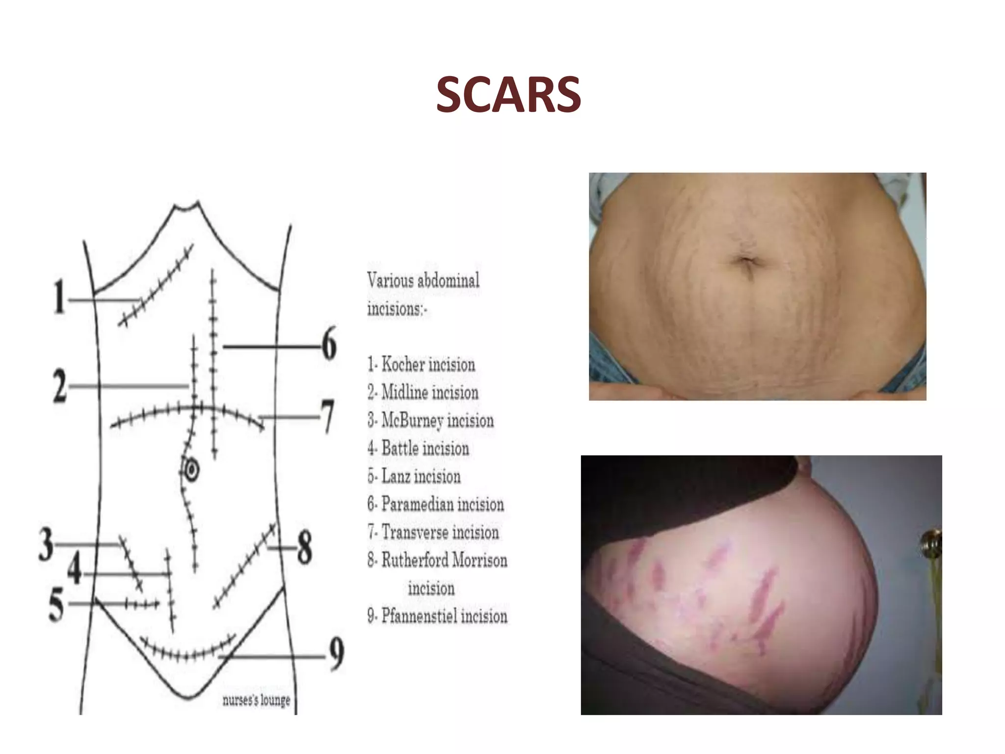 Abdominal examination | PPTX