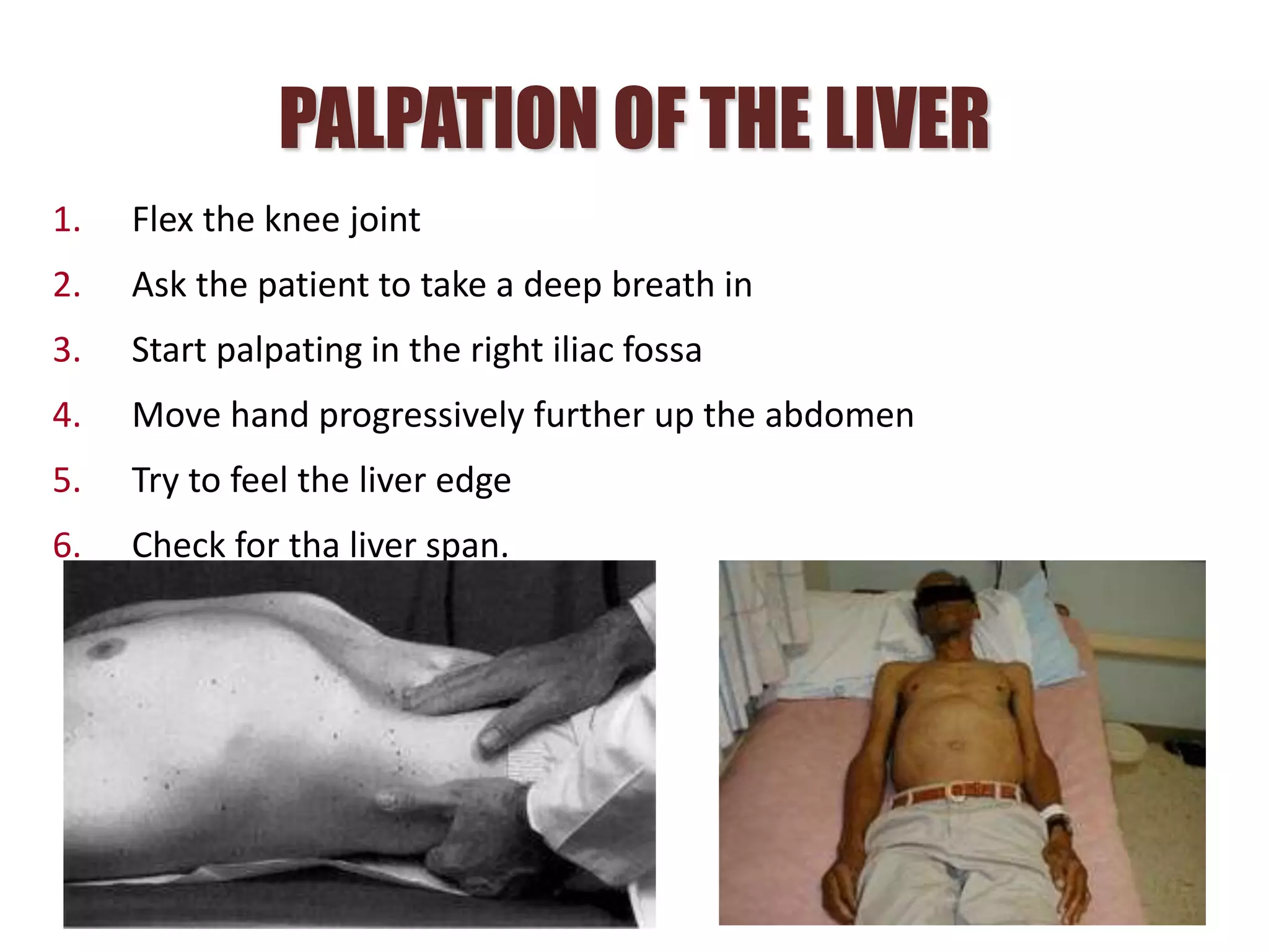 Abdominal examination | PPTX