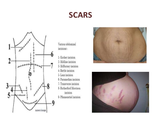 Abdominal examination