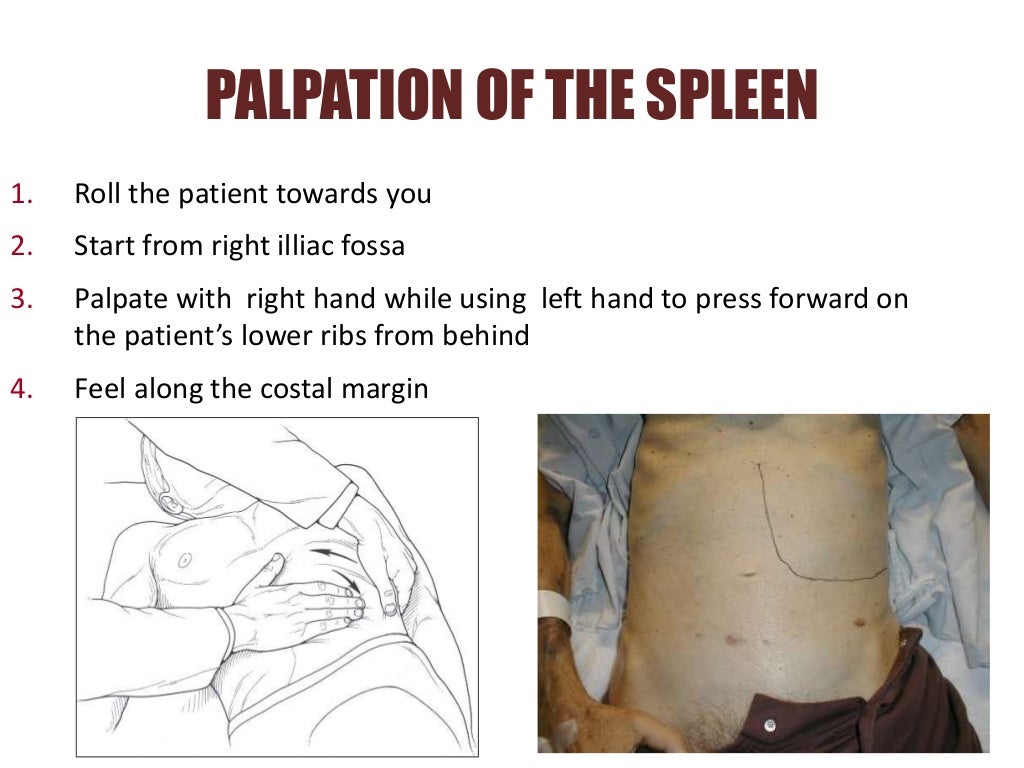 Abdominal examination