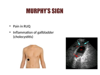 abdominalexamination-150913180504-lva1-app6891 (1).pptx