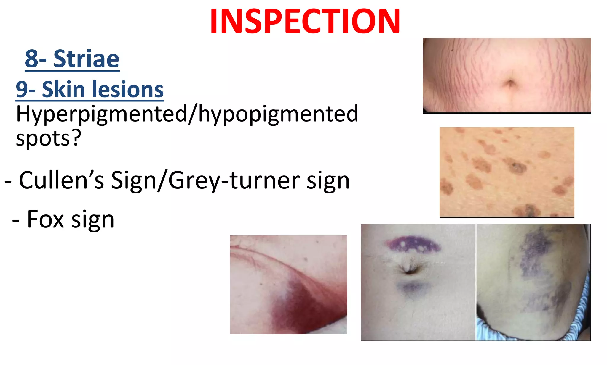 Abdominal examination | PPTX